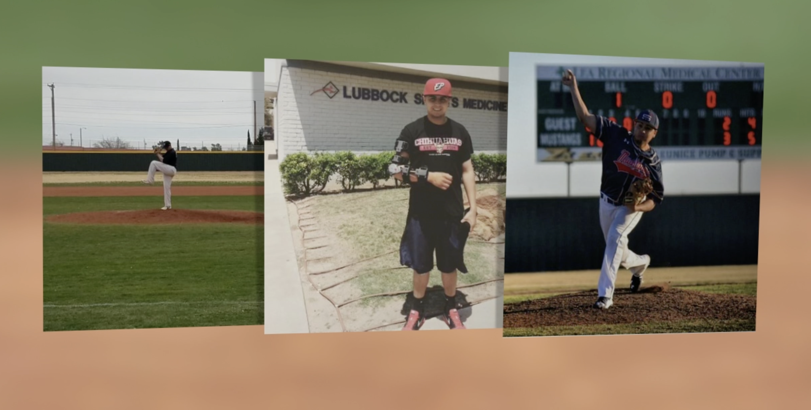The Pitching Epidemic: the rise in arm injuries impacting todays youth