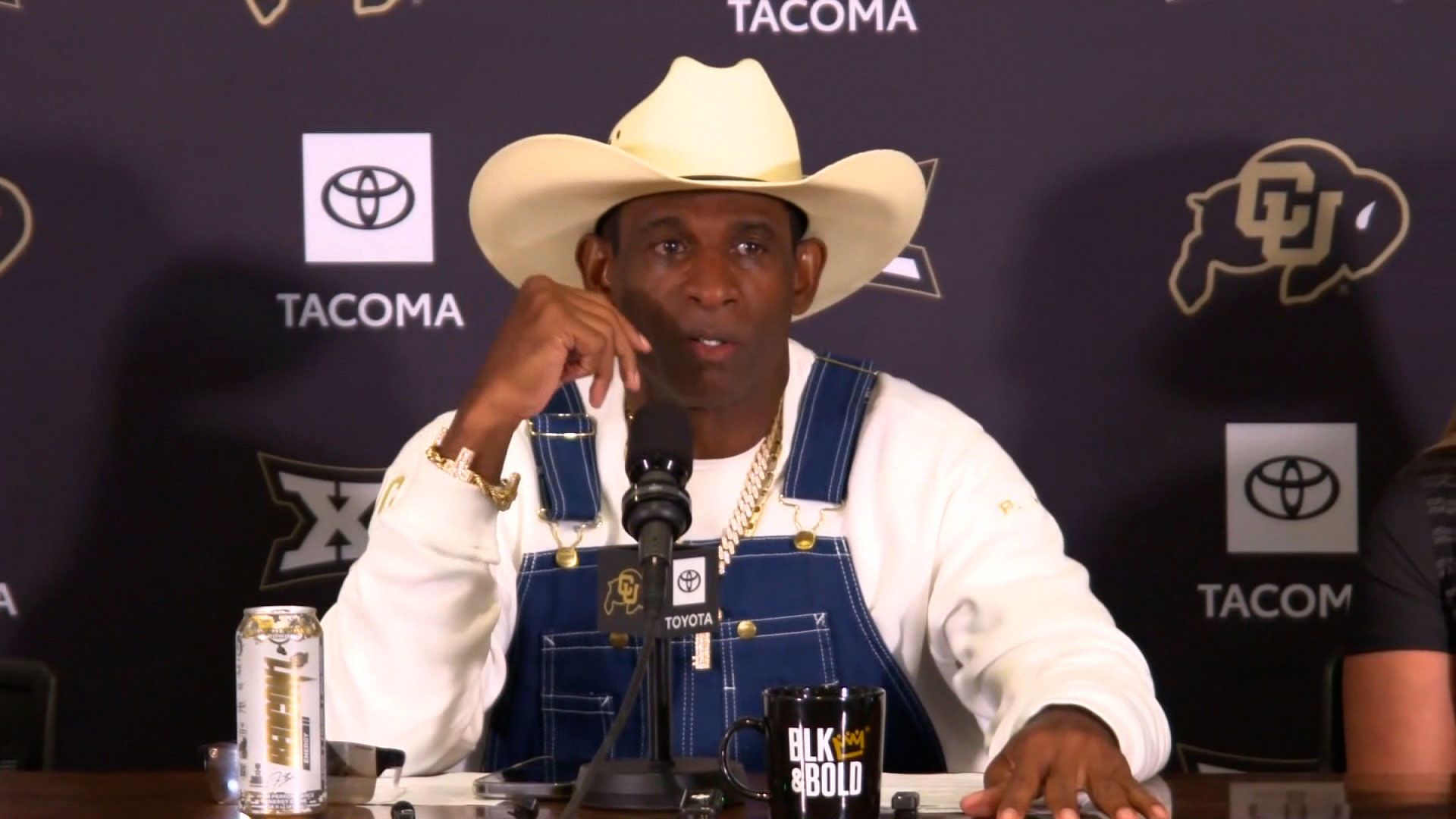 Deion Sanders had his bladder removed earlier this year after doctors ...