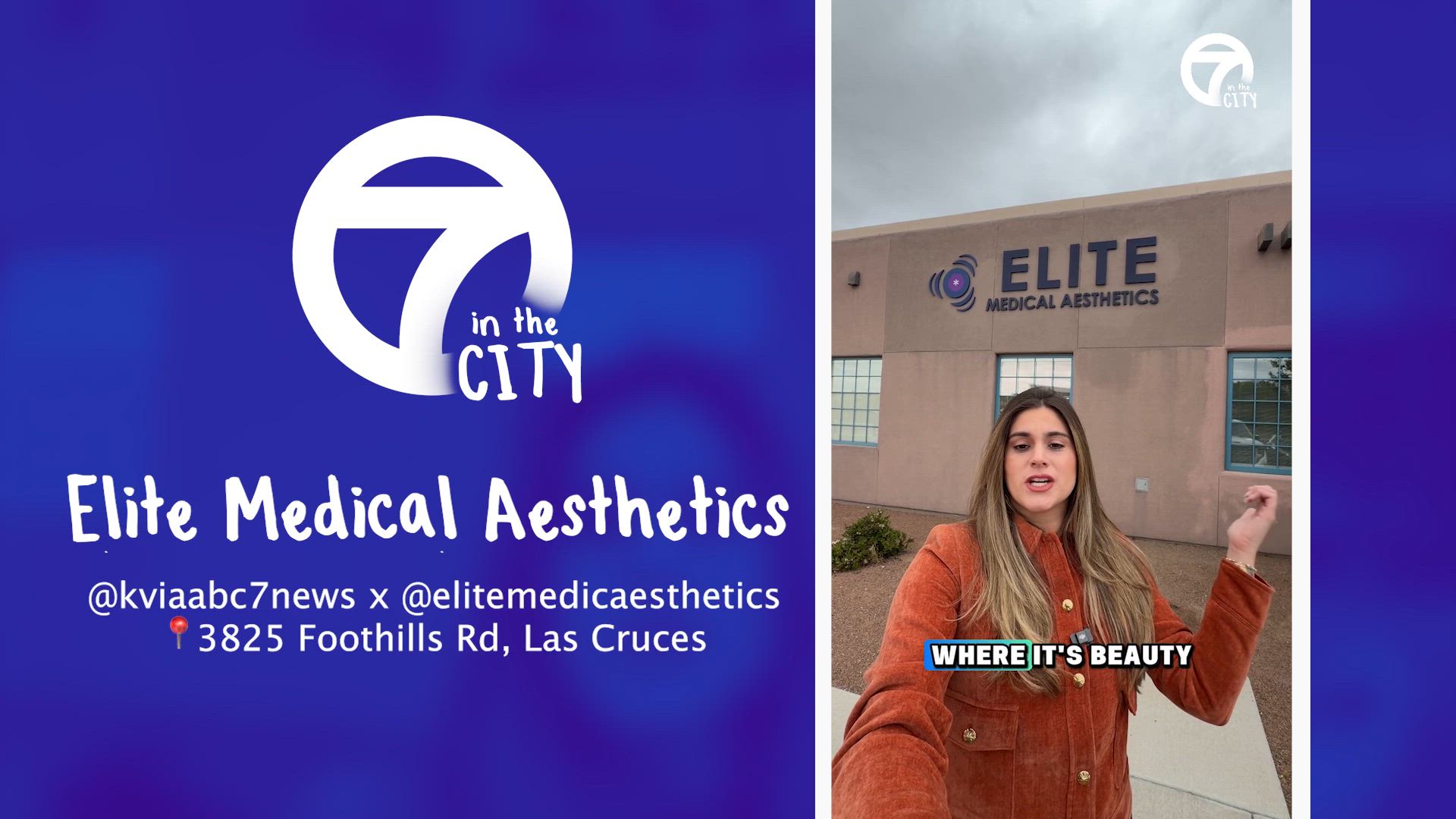 Elite Medical Aesthetics - 7 in the City - KVIA